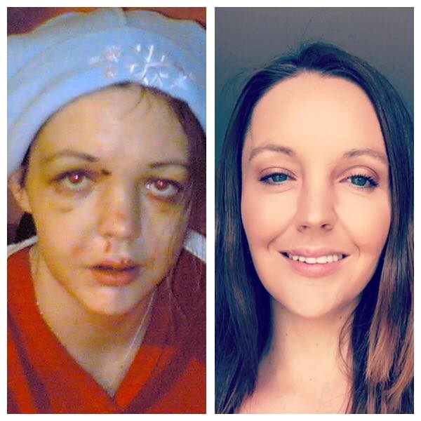 Woman left with no forehead after putting her feet on dashbo - Driven ...